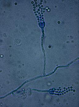 Penicillium Conidia 400x
