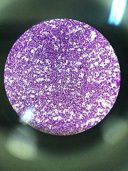 Gram Negative Bacilli E Coli